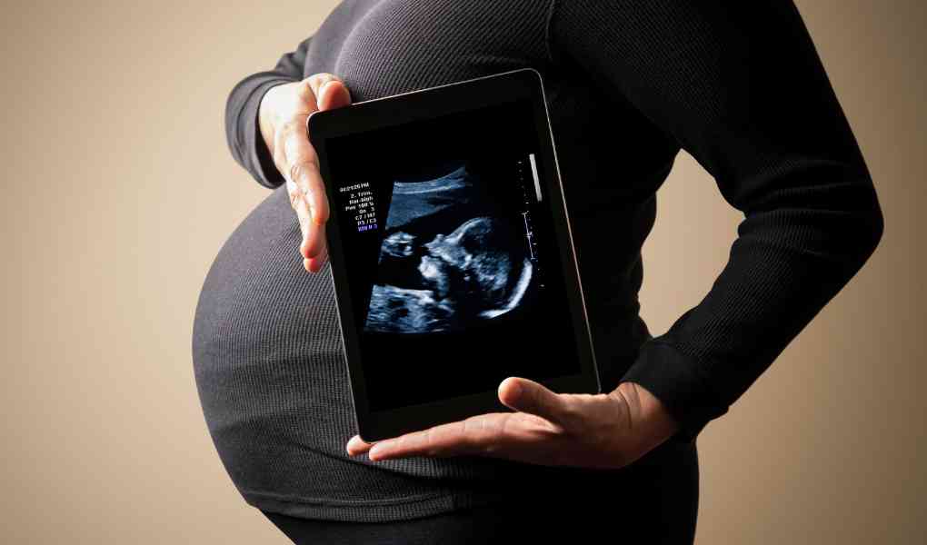 Ketahui Cara Membaca Hasil USG Kehamilan